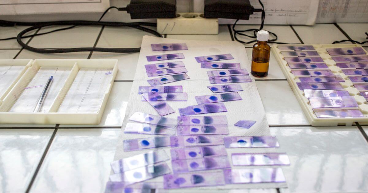 Research Roundup: Malaria R&D, COVID-19 drug candidates, and Ebola ...