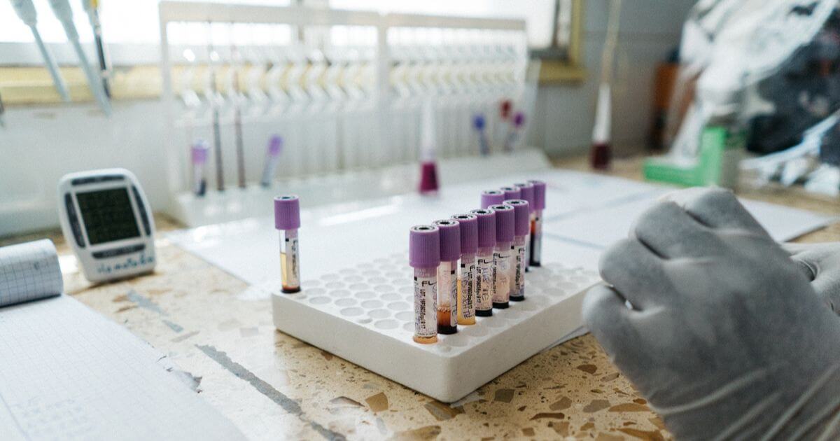 2022 G-FINDER report highlights the inadequacy of global health R&D funding